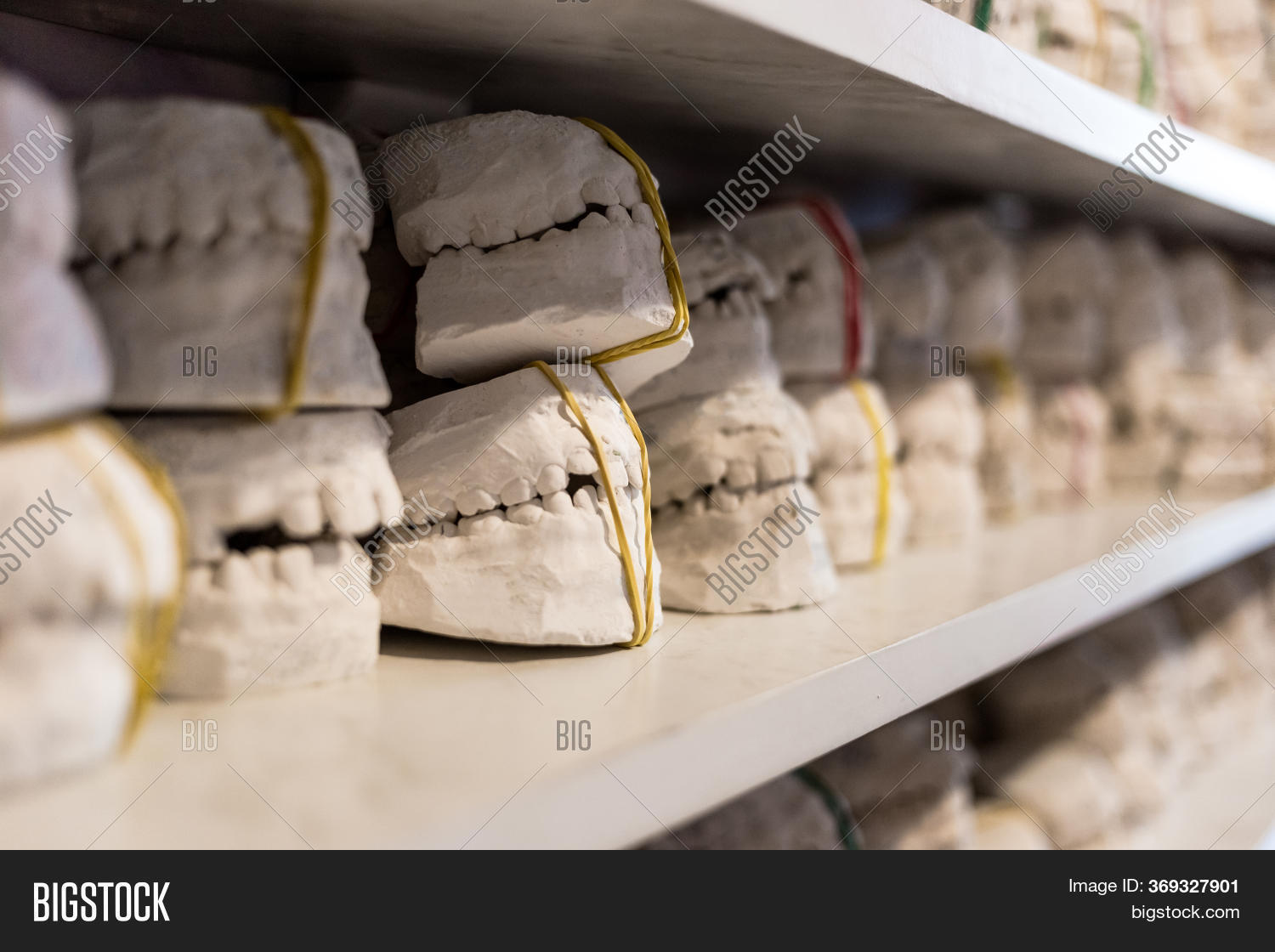 Dental Gypsum Models Image & Photo (Free Trial) | Bigstock