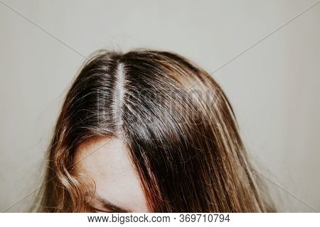 Dark Roots Hair, Image & Photo (Free Trial) | Bigstock