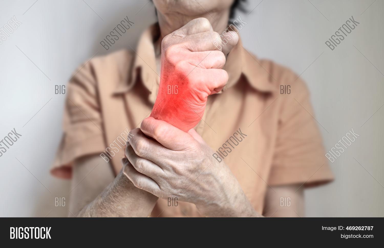 Inflammation Hand Image & Photo (Free Trial) | Bigstock