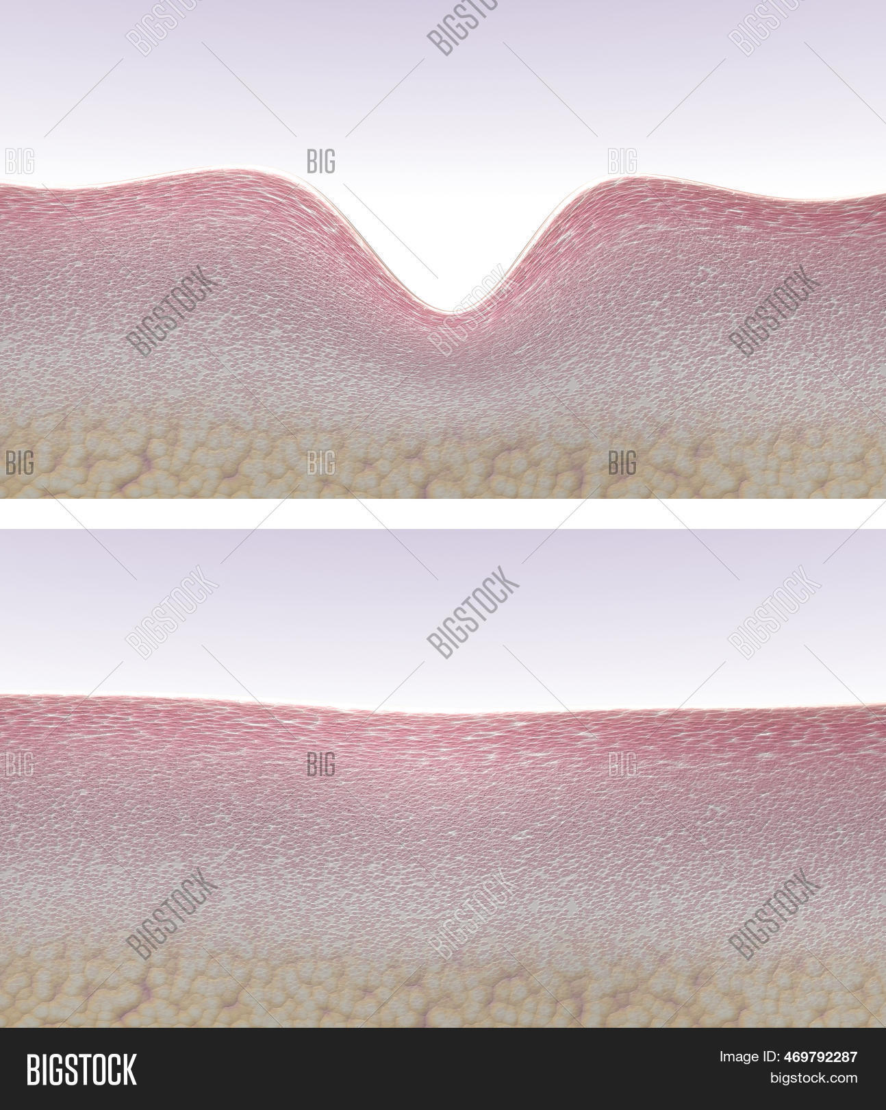 Skin Tissues Cross- Image & Photo (Free Trial) | Bigstock