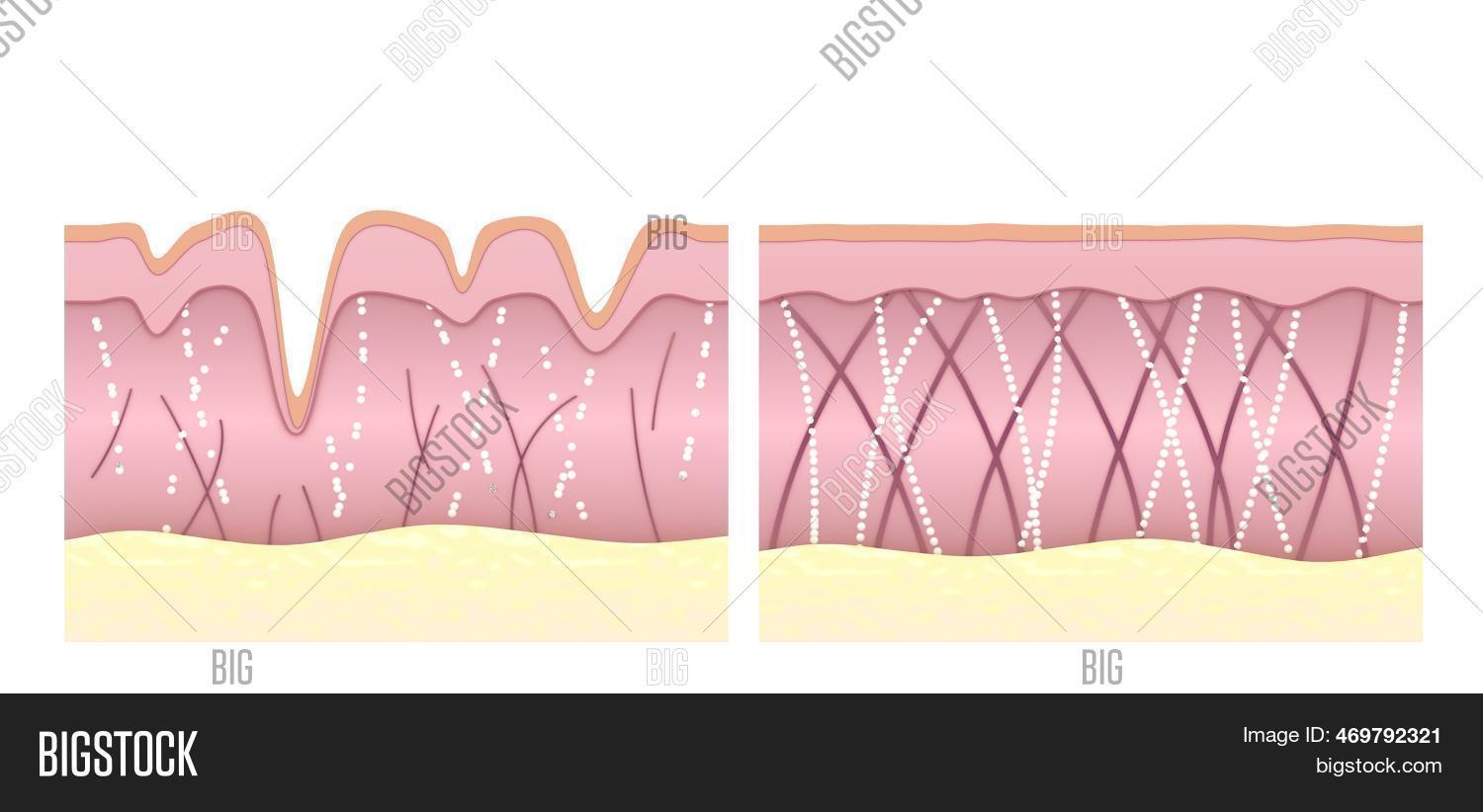 Collagen Elastin Image & Photo (Free Trial) | Bigstock
