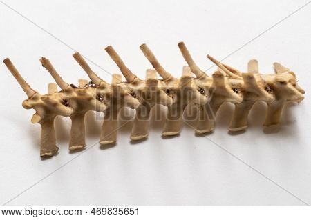 Cervical Vertebra Part Image & Photo (Free Trial) | Bigstock