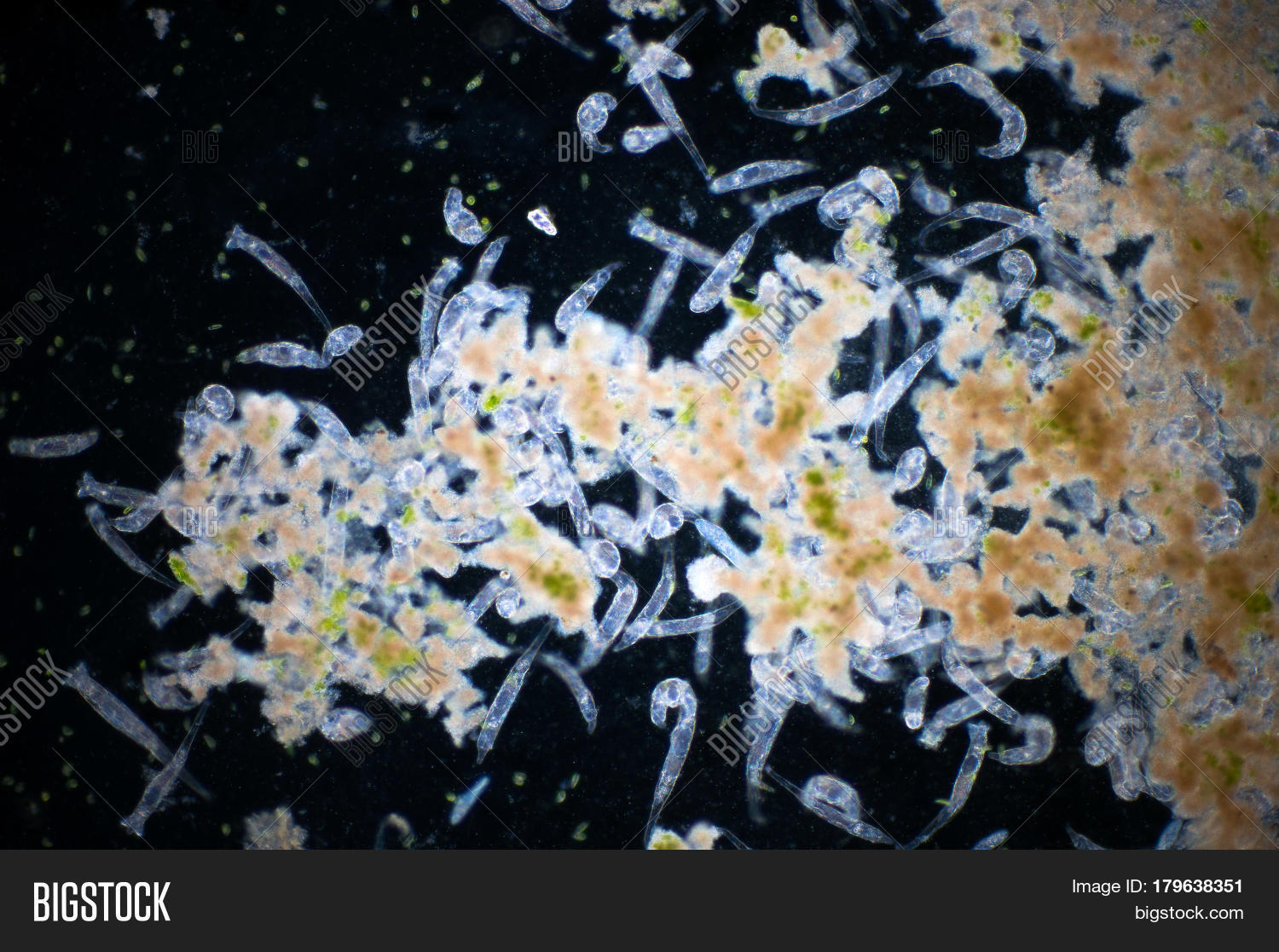 Rotifer (Rotifera Image & Photo (Free Trial) | Bigstock