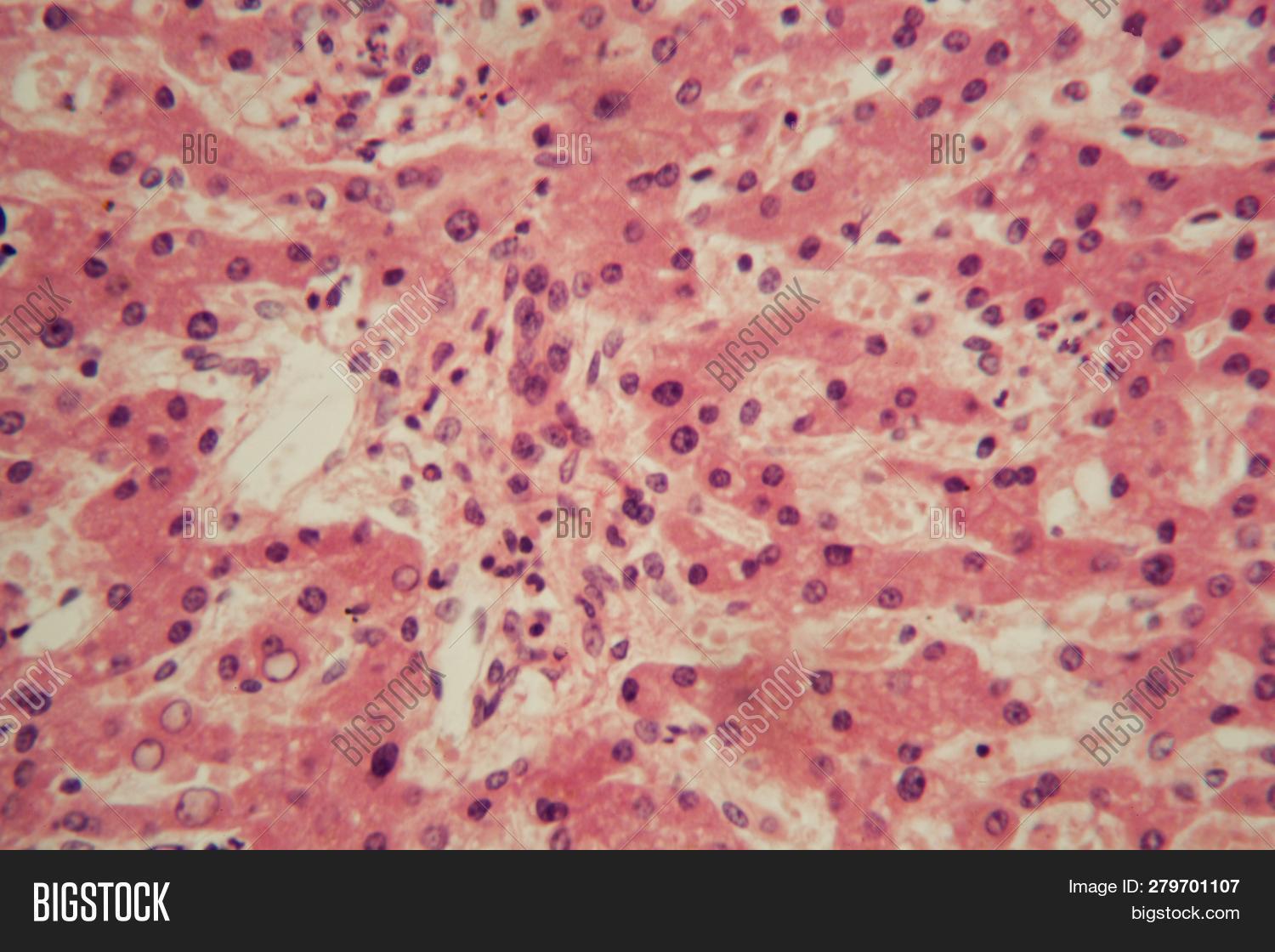 Human Liver Cells Under Microscope