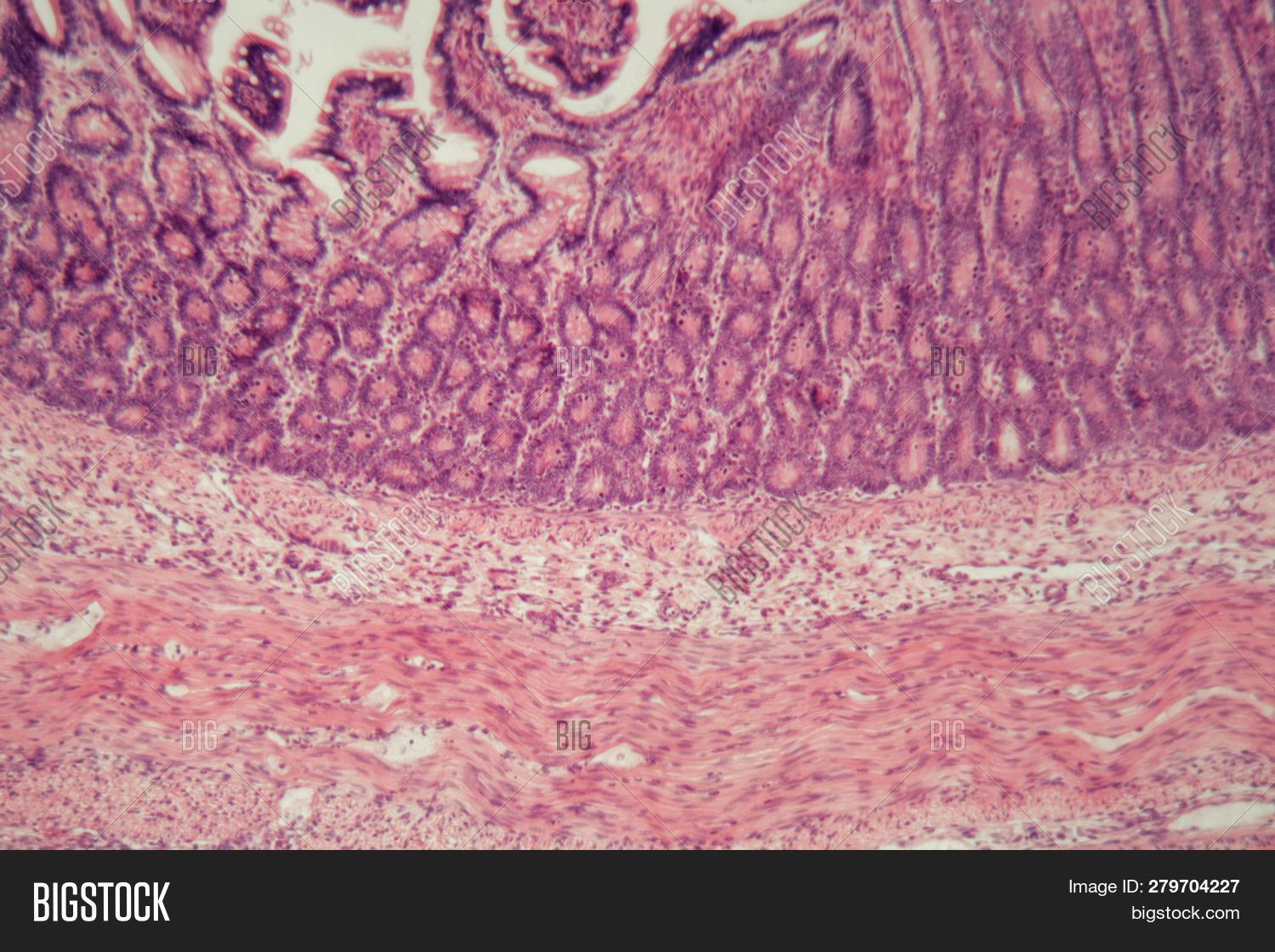 Microscope Photo Large Image & Photo (Free Trial) | Bigstock