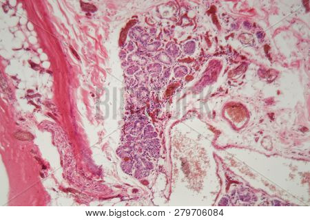 Human Lung Tissue Image & Photo (Free Trial) | Bigstock