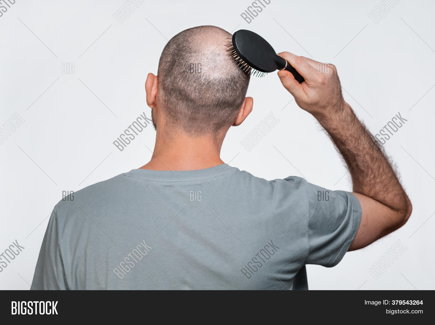 Man Combs His Bald Image & Photo (Free Trial) | Bigstock