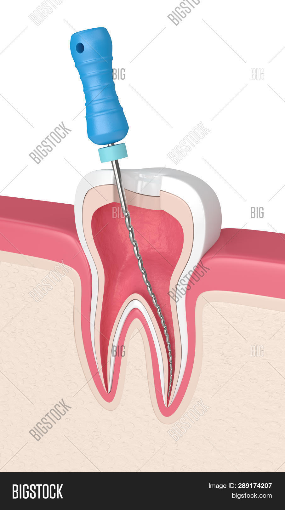 3d Render Tooth Image & Photo (Free Trial) | Bigstock