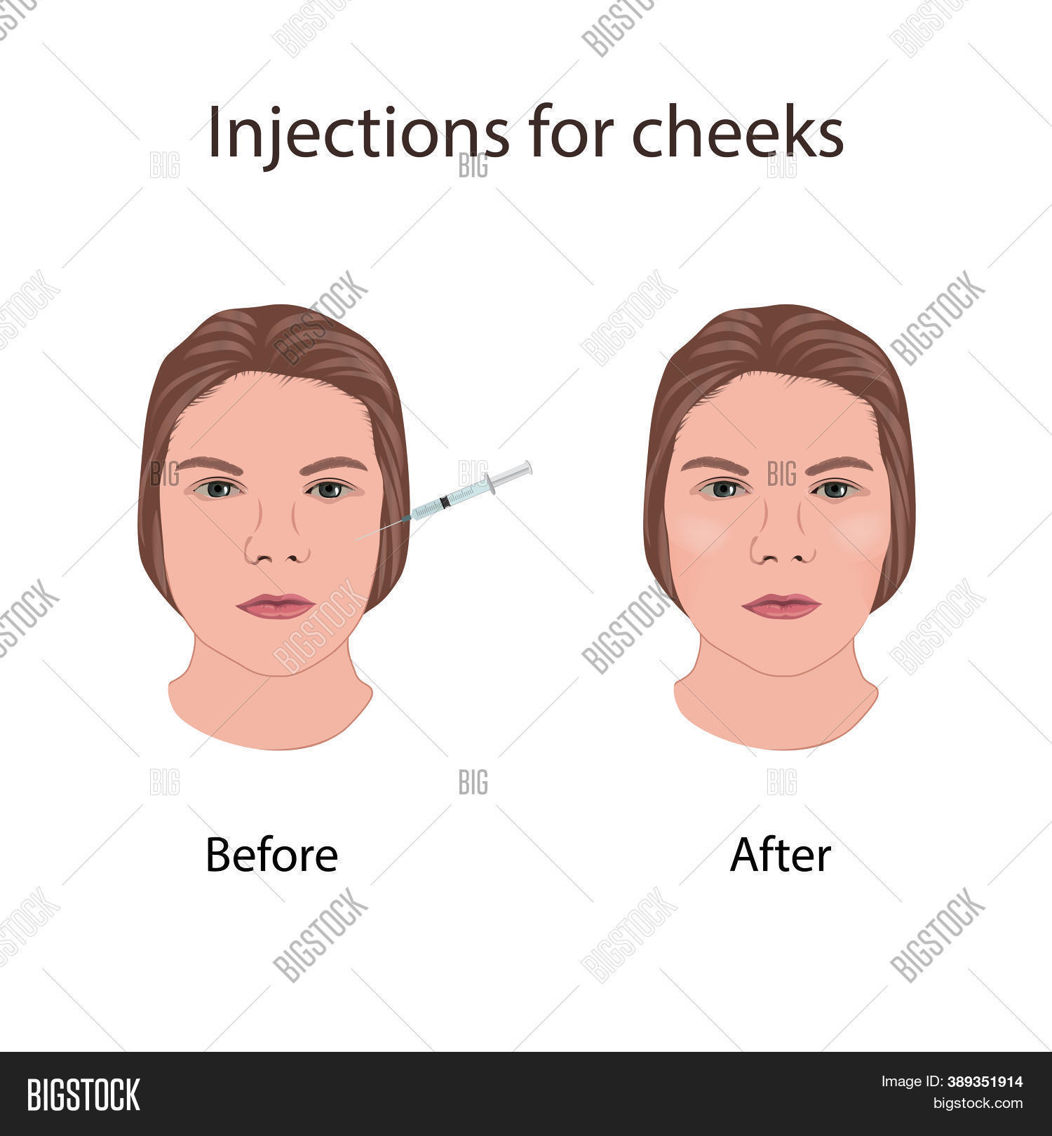 Injections Cheeks. Image & Photo (Free Trial) | Bigstock