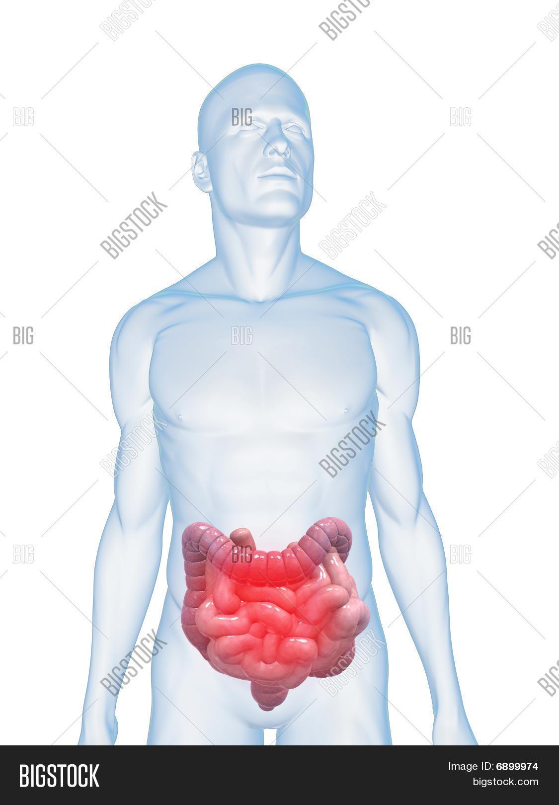 Inflamed Intestines Image & Photo (Free Trial) | Bigstock
