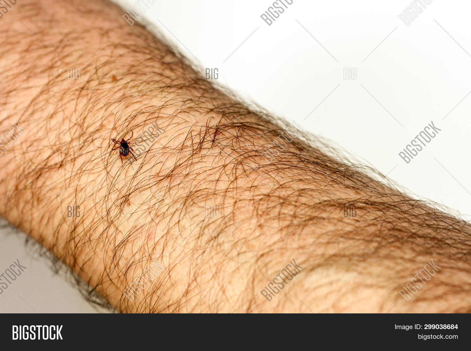 Tick Engorged Blood Image & Photo (Free Trial) | Bigstock