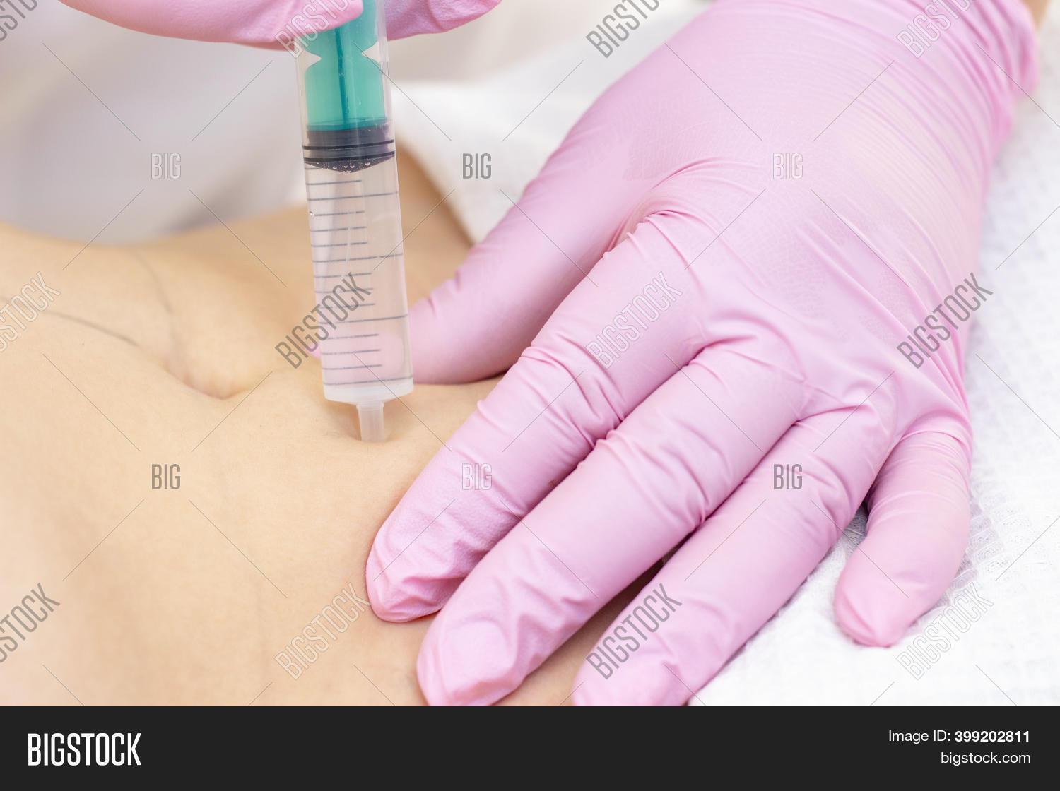Lipolytic Injections Image & Photo (Free Trial) | Bigstock