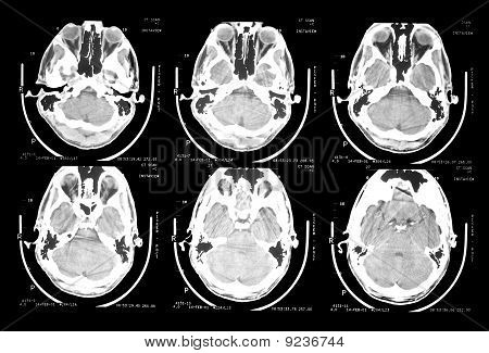 Ct Scan Brain Image & Photo | Bigstock